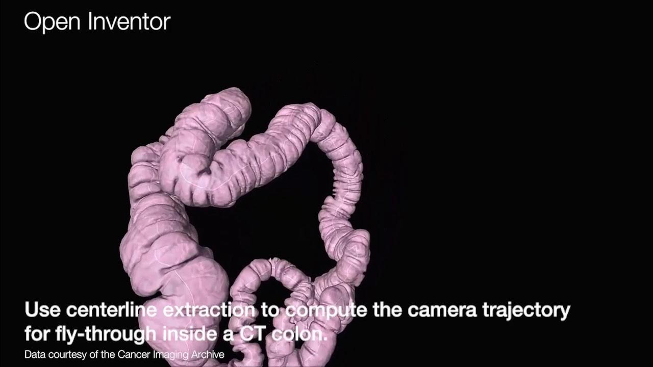 Open Inventor Toolkit | Centerline Extraction | 3D Visualization ...