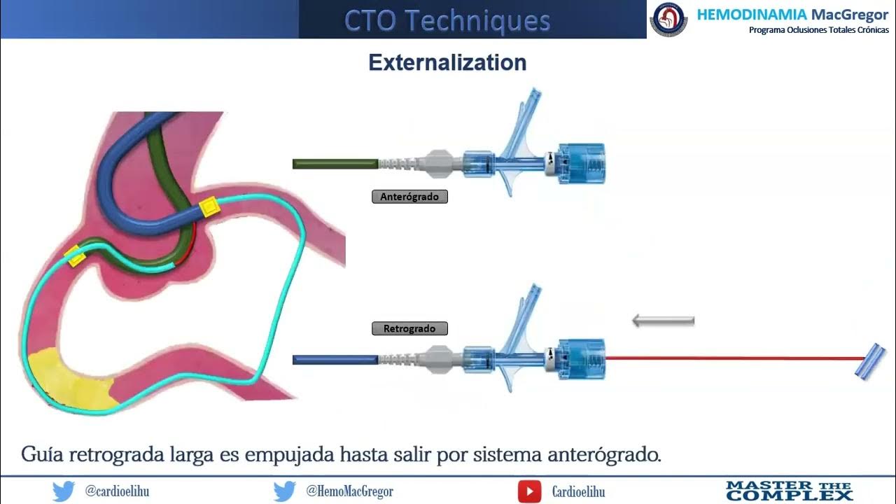 Externalization Youtube