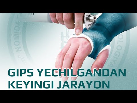 Gips yechilgandan keyingi jarayon +998900337076