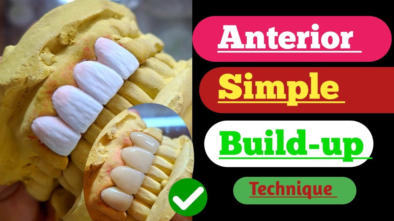 Anterior Simple Build up Technique| Ceramic Porcelain| Anatomy| Dental ...