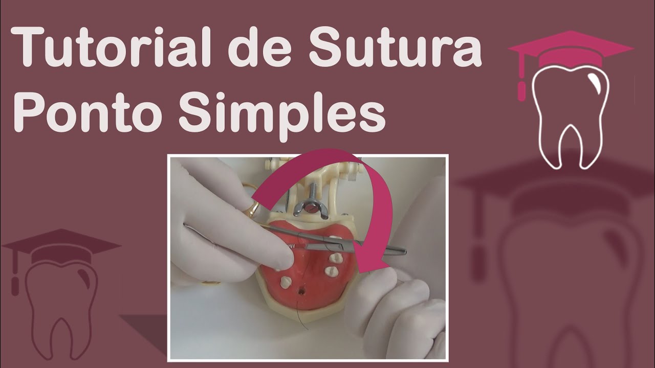 Tutorial de Sutura - Ponto Simples - YouTube