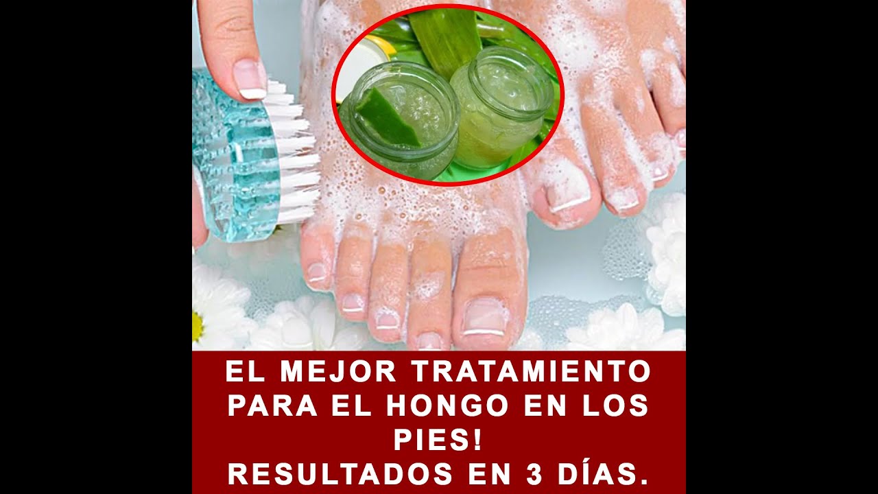 Foot trooper el major tratamiento para el hongo en los pies! - YouTube