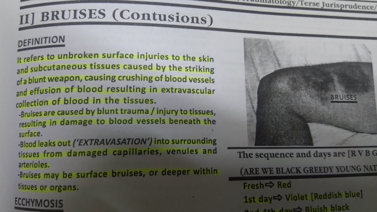 Bruises - FORENSIC - YouTube