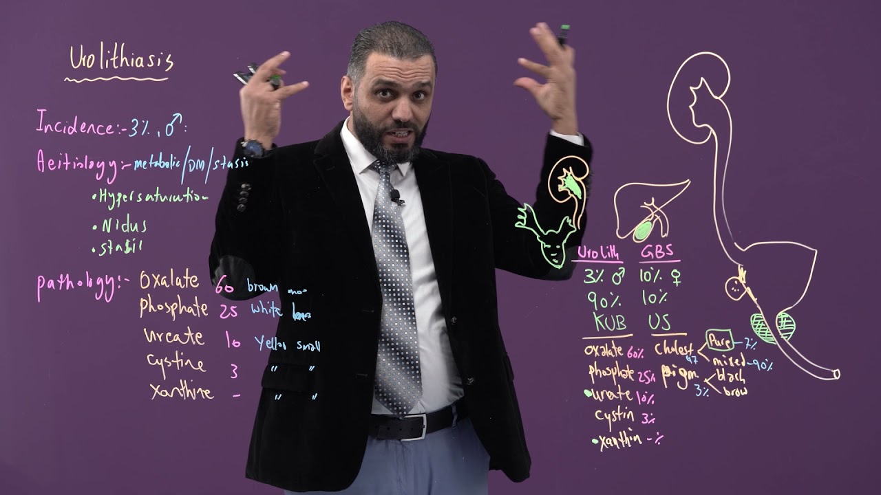 Urinary Stones by Dr.khalid Milad - YouTube