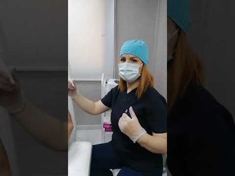 FAÇA İZİ JİLET İZİ TEDAVİSİ