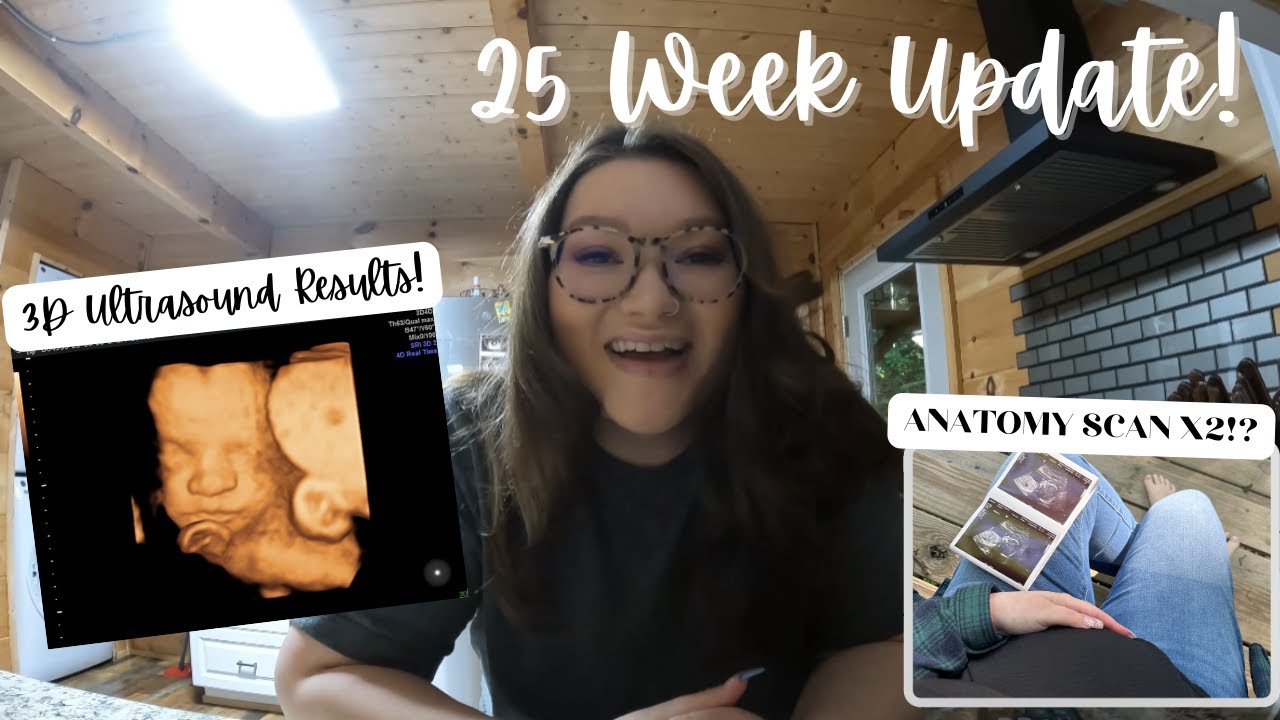 25 Week Update! | Symptoms, Anatomy Scan, Elective 3D Ultrasound ...