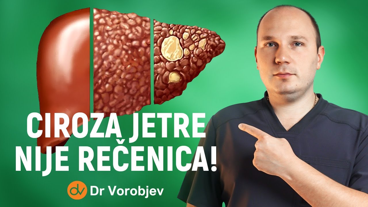 To će vas ubiti! Ne dozvolite da stigne do ciroze! - YouTube