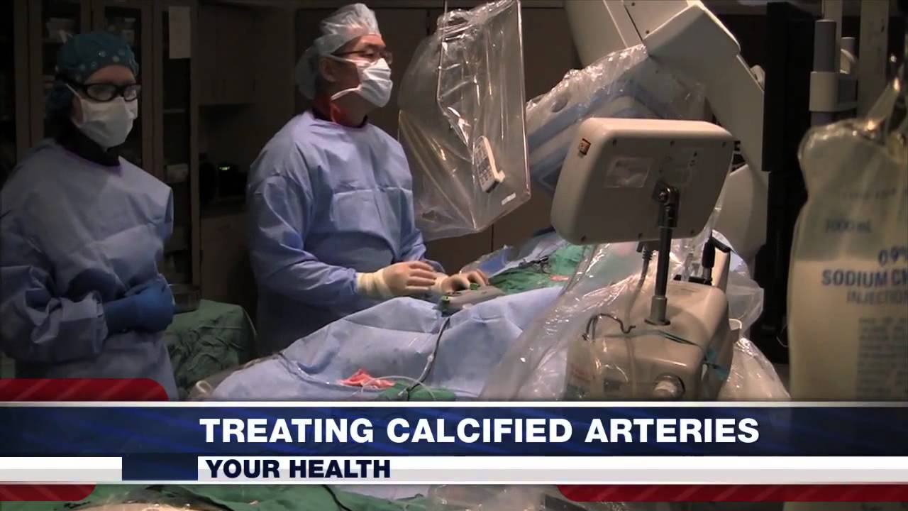 Calcified Artery Treatment, Dr. Arthur Lee, Dec 18, 2013, WCJB TV20 ...