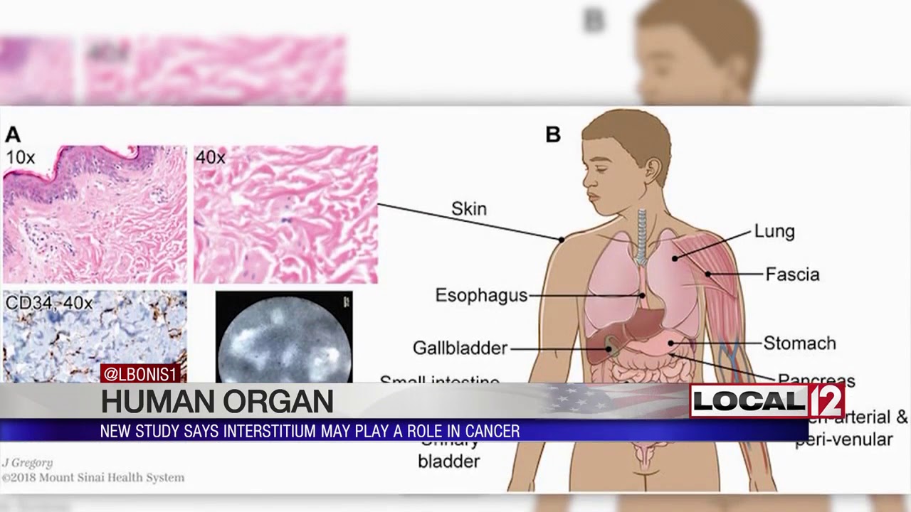 A "new" organ? Study says "Interstitium" may play a role in cancer ...