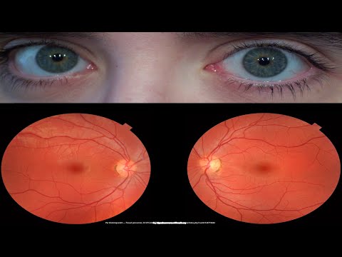 The Pursuit of Good Enough, Not Perfection (Part 2: Humans)