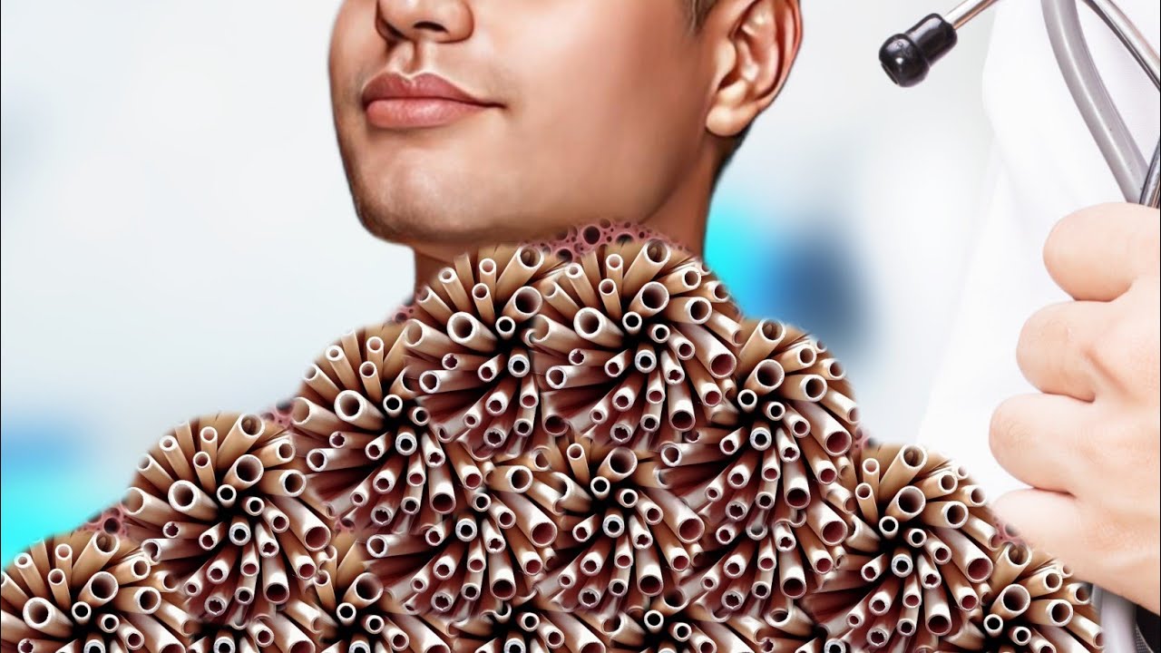 ASMR Healing Asmr Animation | incent Man Neck Infection | animation ...