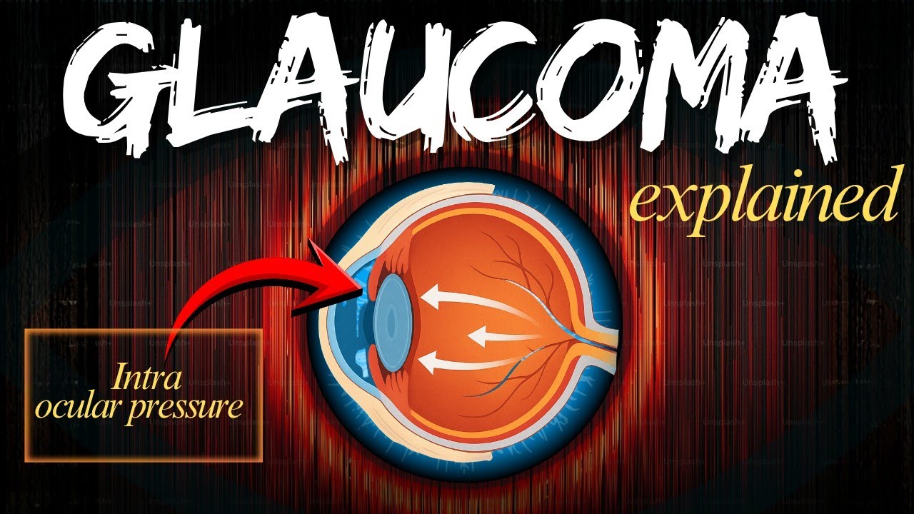 What is glucoma? - YouTube