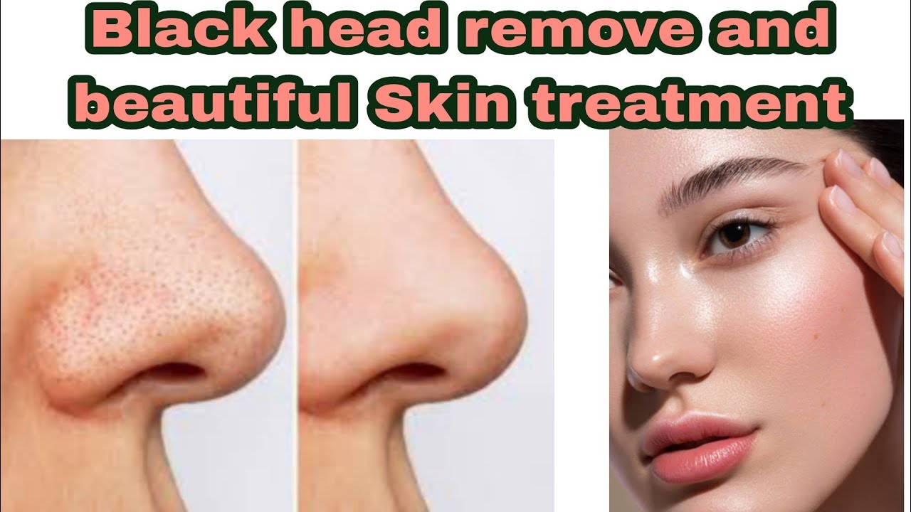 Black head remove l Glow and beautiful Skin l mirab beauty salon - YouTube