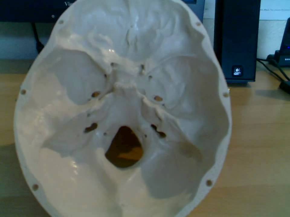 Skull 3: Anatomy of the internal cranium (including cranial nerves ...
