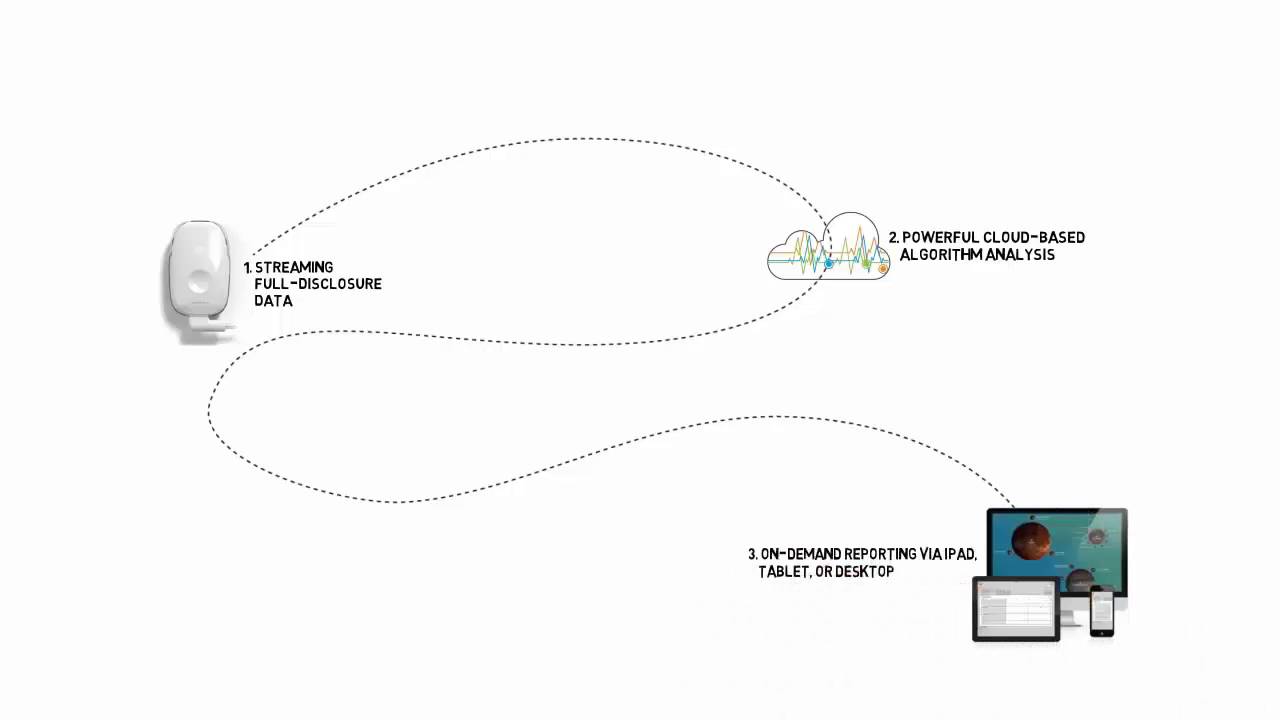 InfoBionic MoMe® Kardia Whiteboard - YouTube