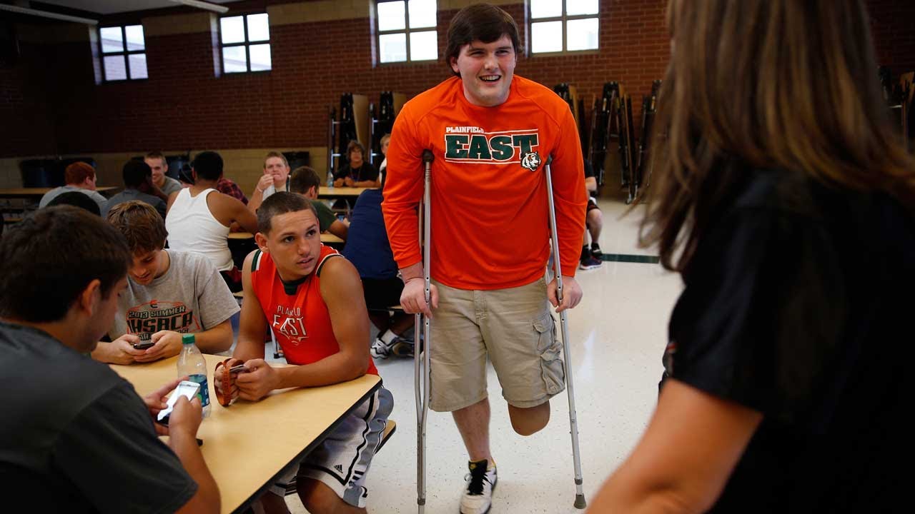 Student athlete with leg amputated motivates others - YouTube