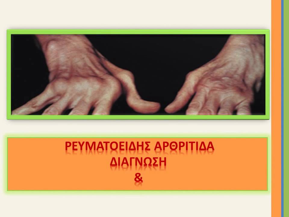 ΡΕΥΜΑΤΟΛΟΓΙΚΟ ΙΑΤΡΕΙΟ ΞΕΝΟΣ Μ ΙΩΑΝΝΗΣ ΒΕΡΟΙΑ - YouTube