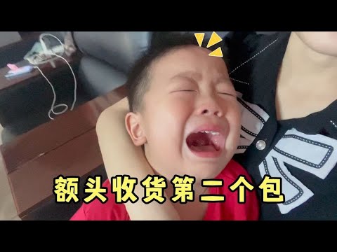暑假还没过半，辉辉的额头就收货两个包了，宝妈看着既心疼又好笑 - YouTube