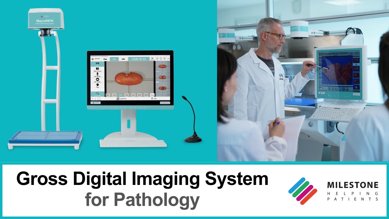 MacroPATH: Macro Digital Imaging System - How it Works - YouTube