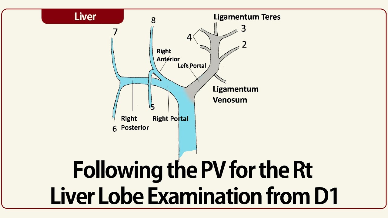 Linear EUS : Following the PV for the Right Liver Lobe Examination from ...