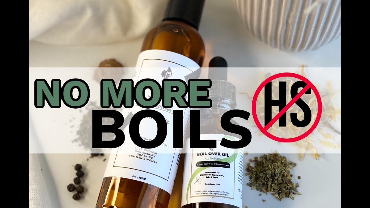 How to get rid of painful boils, cysts & hidradenitis suppurativa (HS ...