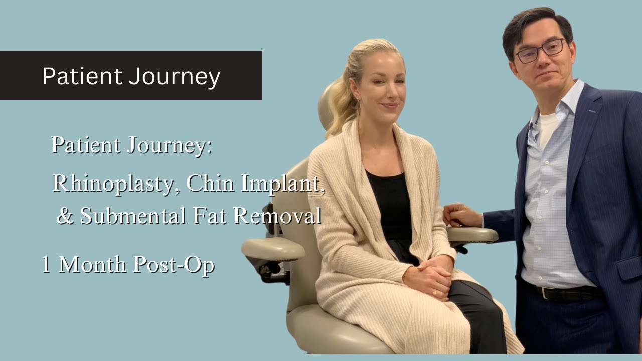 Patient Journey: 1-Month Post Op (Rhinoplasty, Chin Implant & Submental ...