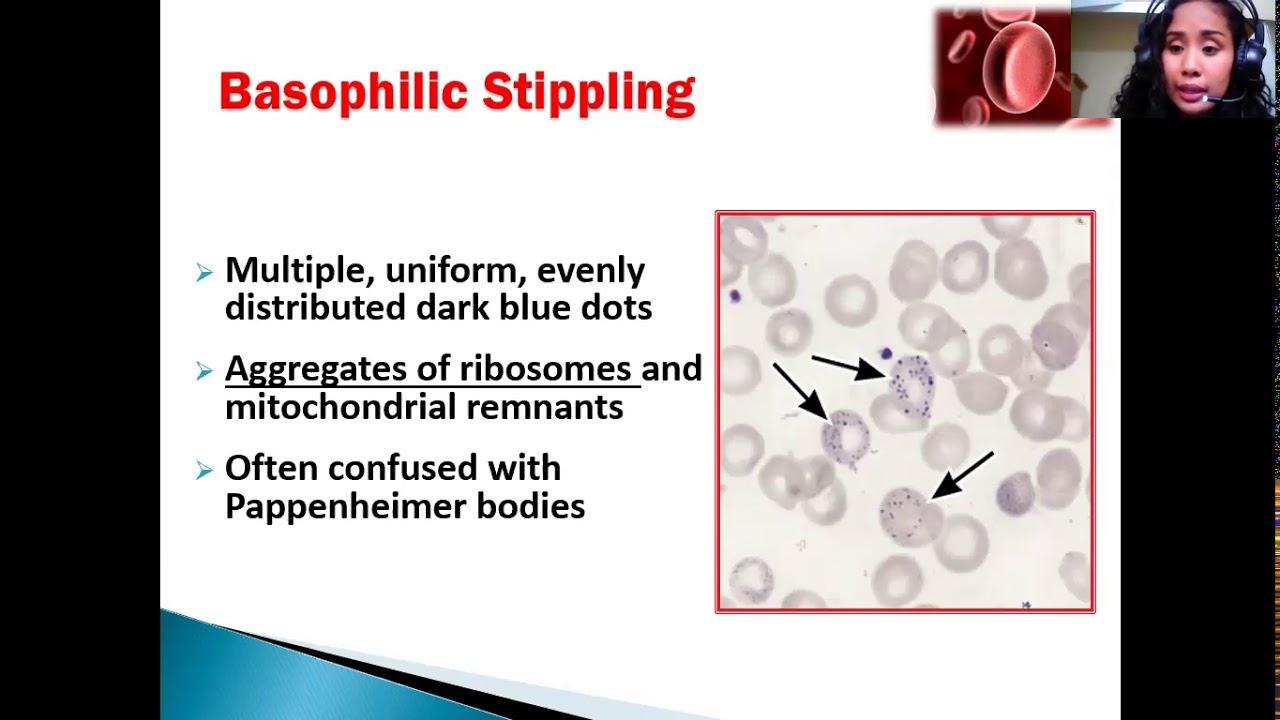 Red blood cell inclusions - YouTube