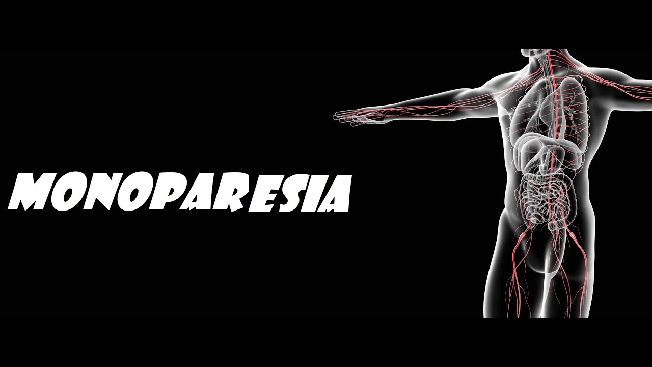 Monoparesia de Miembro Inferior (Indicaciones - ejercicios en casa ...