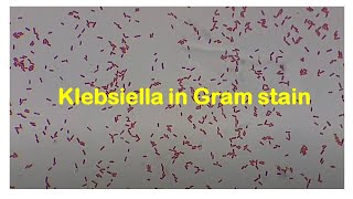Klebsiella Negative Stain