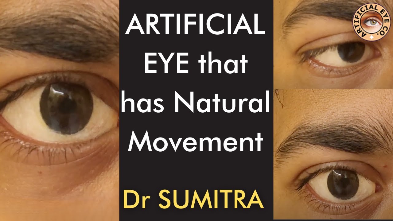 ARTIFICIAL EYE that has Natural Movement Forever | Dr Sumitra - YouTube