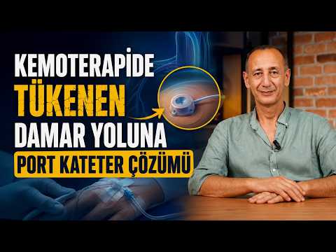 Kemoterapide Port Kateter Nedir? Kimlere Takılır?