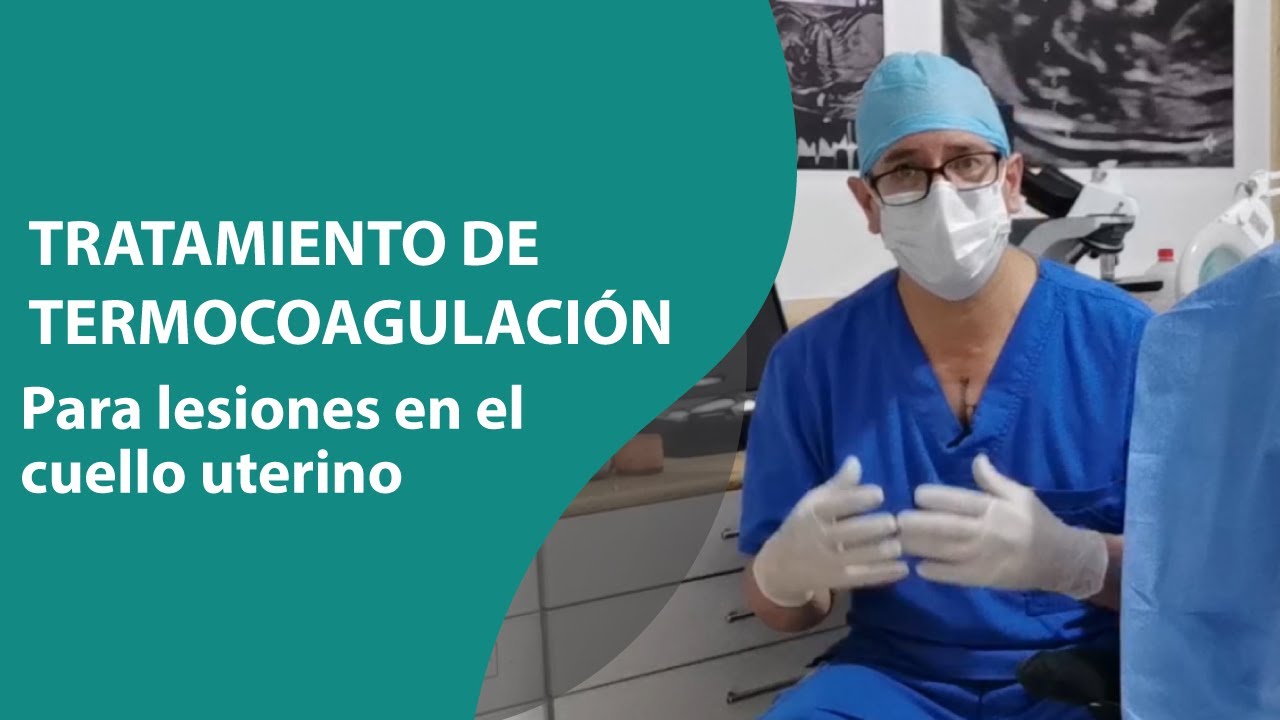 LESIONES PREMALIGNAS -TERMOCOAGULACIÓN - YouTube