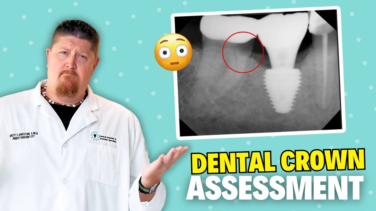 Root Canals, Cavities, and Dental Crowns Assessment in a Dental X--Ray ...