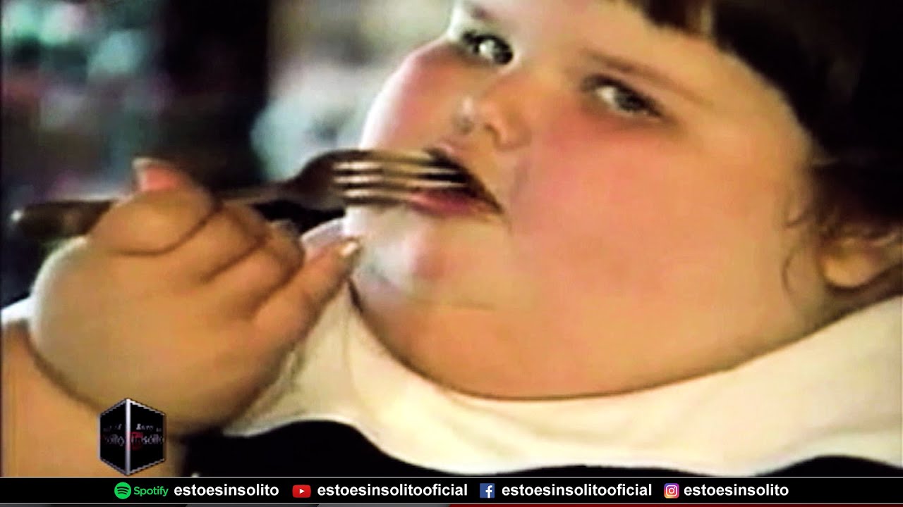 Vean el caso de la #niña más #obesa del #mundo #obesity #increible # ...