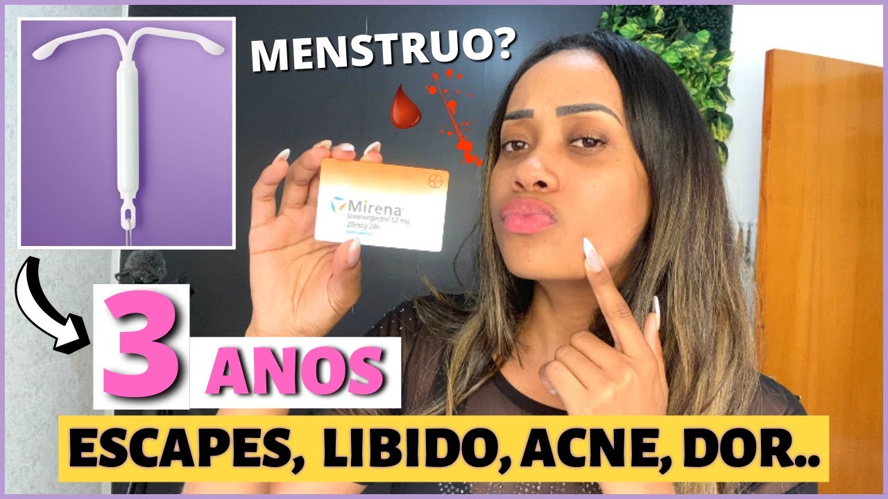DIU MIRENA APÓS 3 ANOS (SIU) - Rejeição, acne, libido, escapes ...