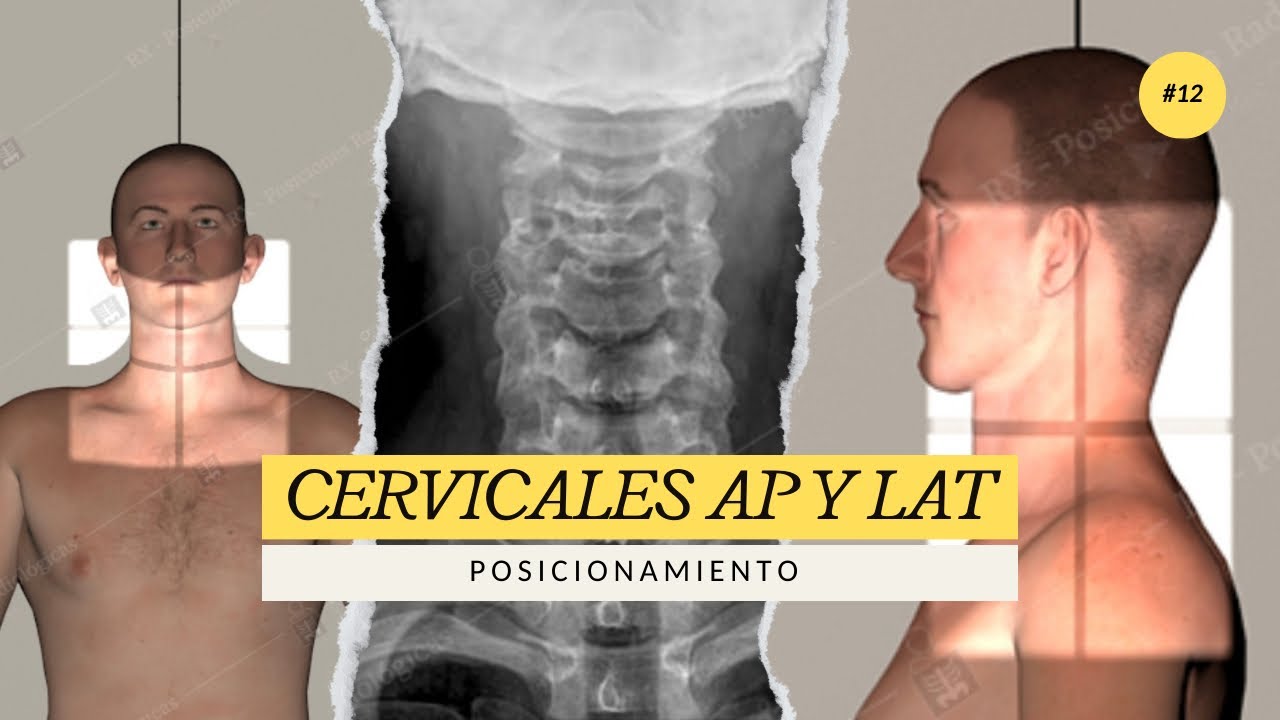 RADIOGRAFÍA COL.CERVICAL (AP Y LAT) POSICIONAMIENTO FACIL Y RAPIDO # ...