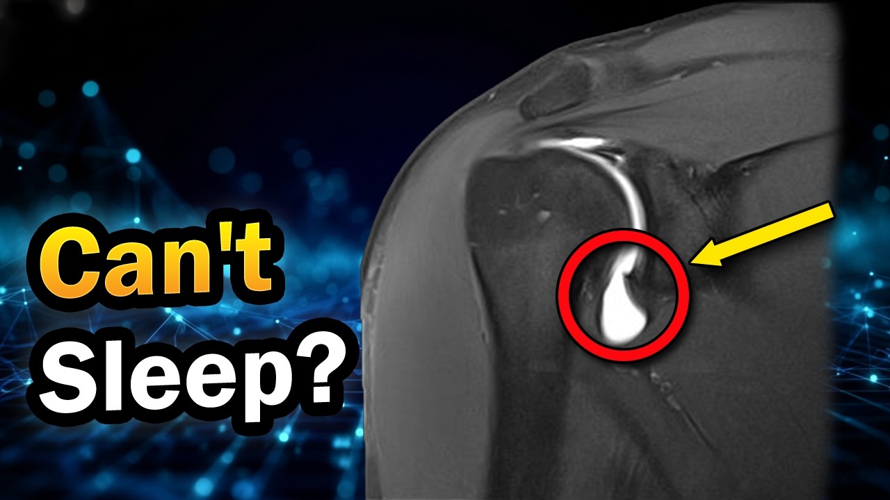 Night Shoulder Pain? Can't Lift Arm? MRI for Rotator Cuff Tears, Labrum ...