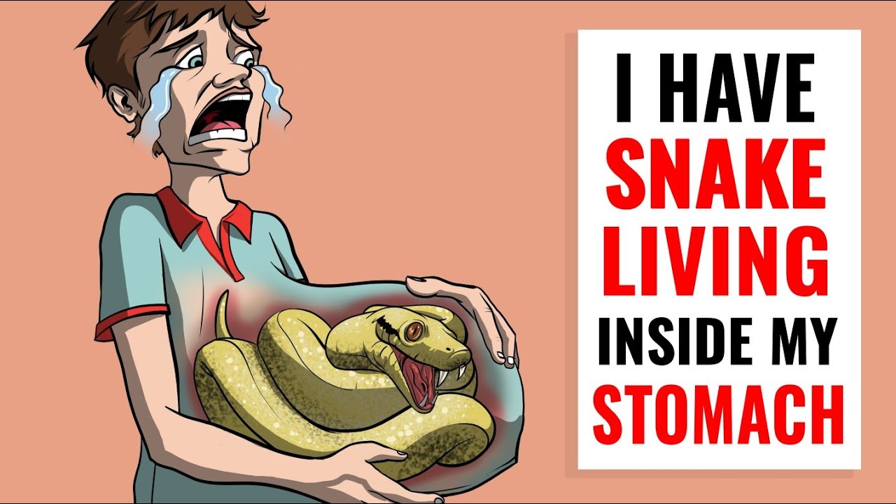 I Have Huge Snake Living Inside Me - YouTube