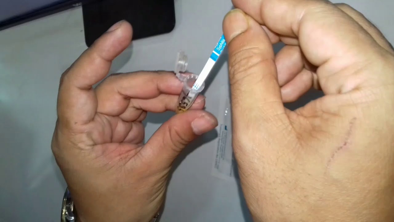 Examination of Siphilis Test (TPHA Test) - YouTube