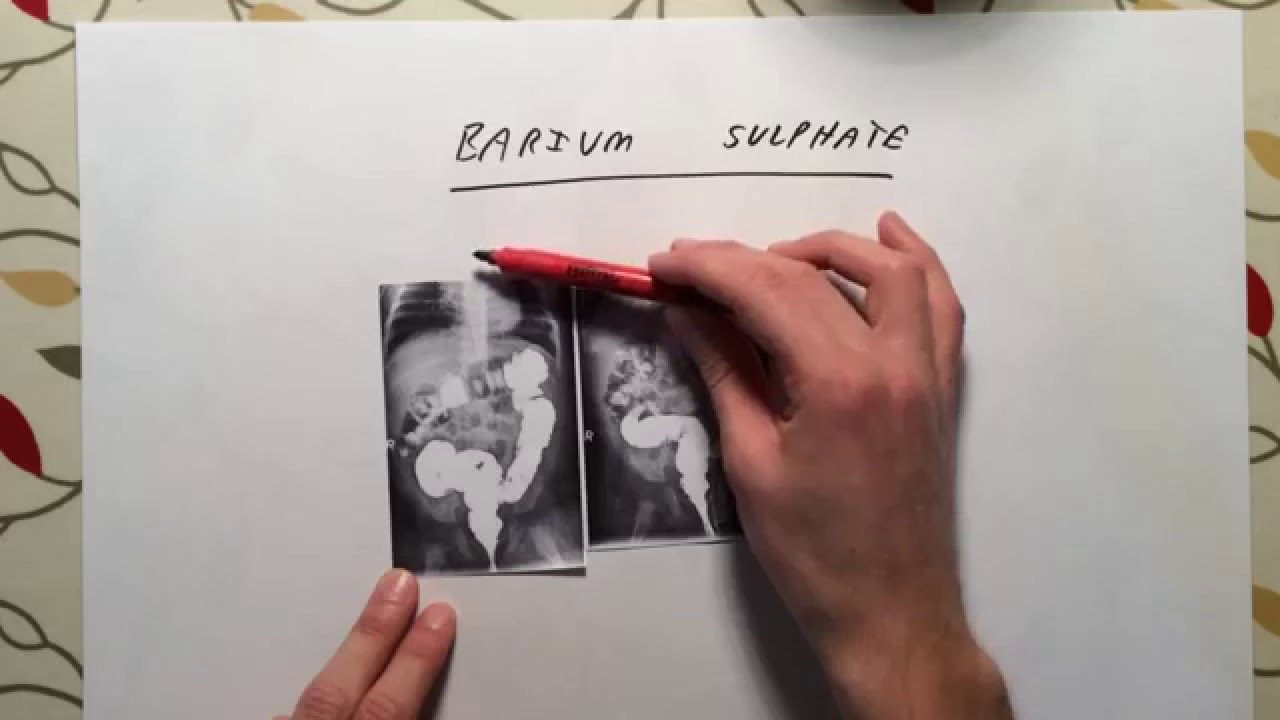 Solubility Rules - GCSE Chemistry - YouTube