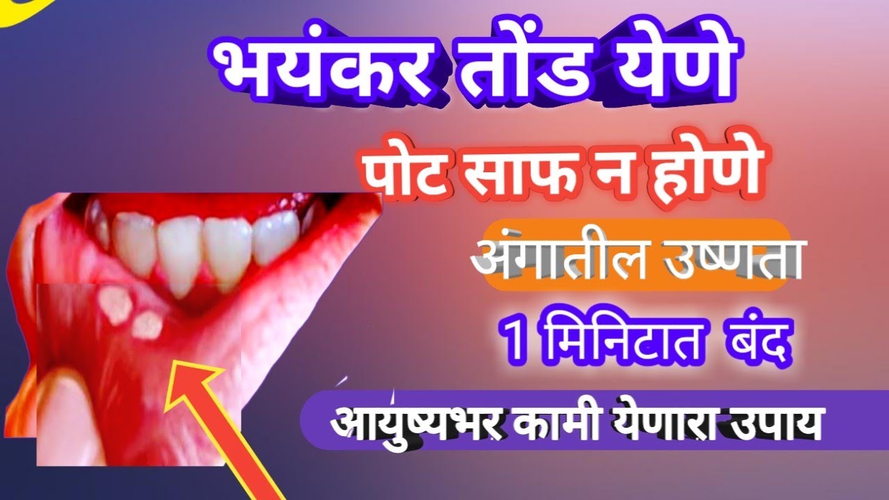 भयंकर तोंड येणे| पोट साफ न होणे | अंगातील उष्णता 1 मिनिटात बंद,tond ...