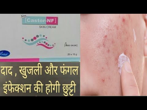 Castor NF Skin Cream benefits - YouTube