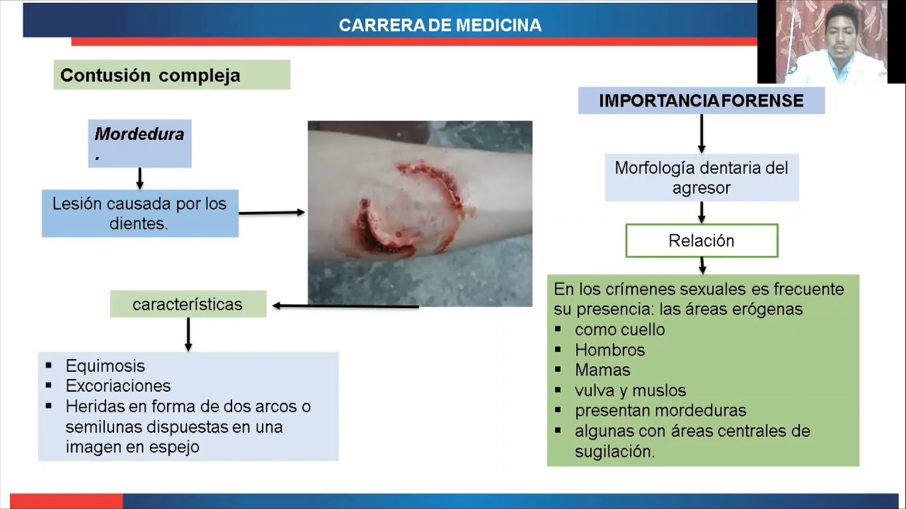 LESIONOLOGÍA CONTUSIONES TIPOS DE HERIDAS - YouTube