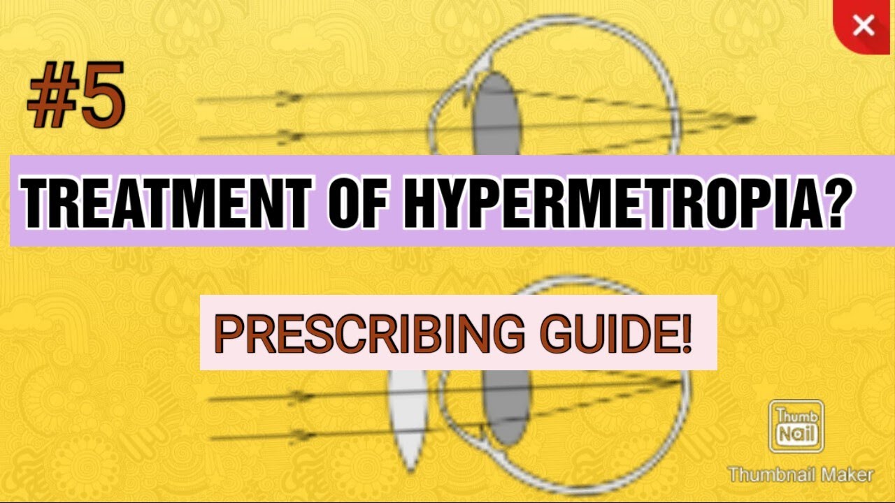#5 TREATMENT OF HYPERMETROPIA || Principles of hypermetropic correction ...