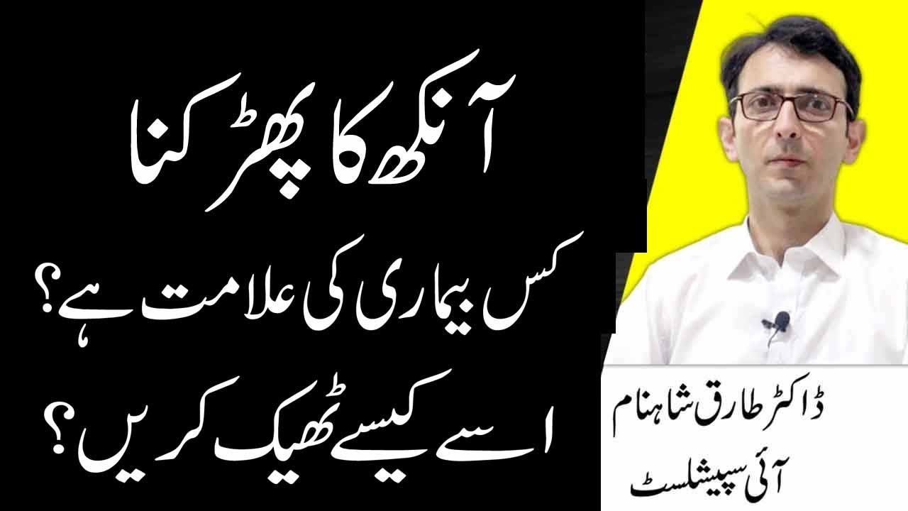 How To Treat Eye Lid Twitching Naturally In Urdu Annkh Ka Pharhakna how-to-treat-eye-lid-twitching-naturally-in-urdu-annkh-ka-pharhakna