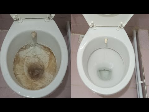 Çok Az Kişi Klozetteki Sarı Lekeler Nasıl Çıkar Bilir ! | Klozet Temizliği Nasıl Yapılır ?