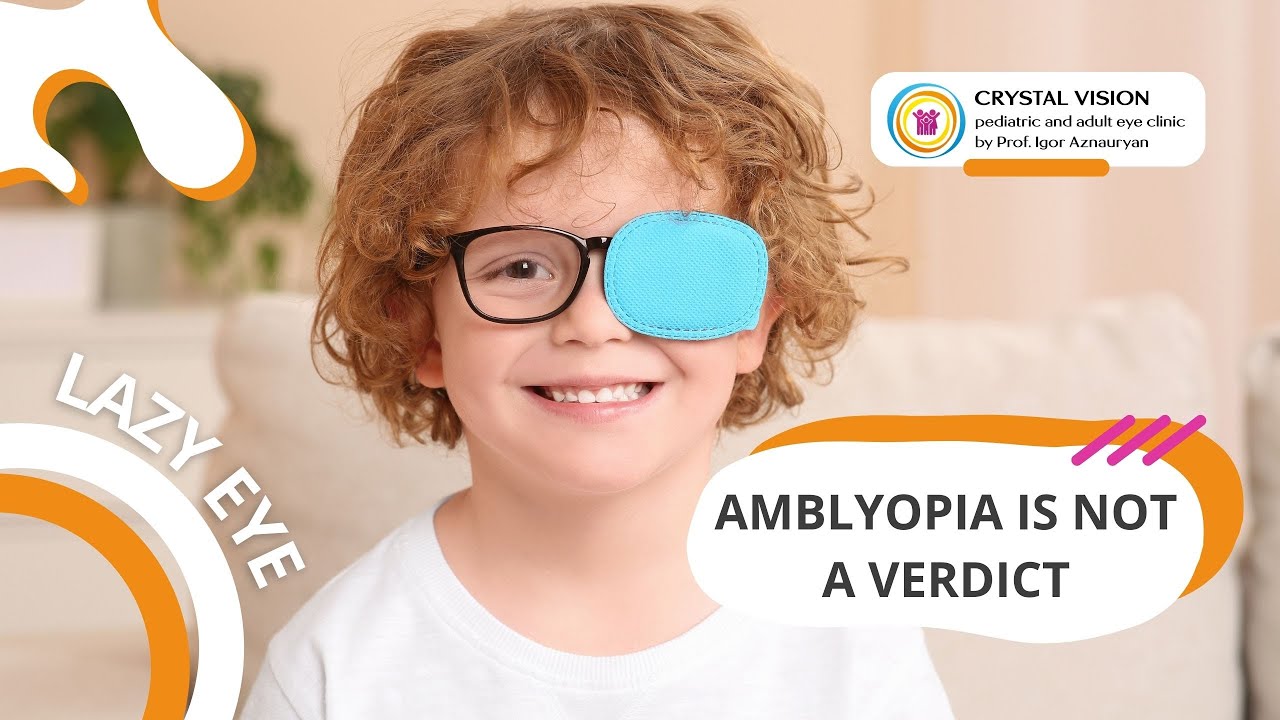 HOW WE TREAT A LAZY EYE. AMBLYOPIA - YouTube