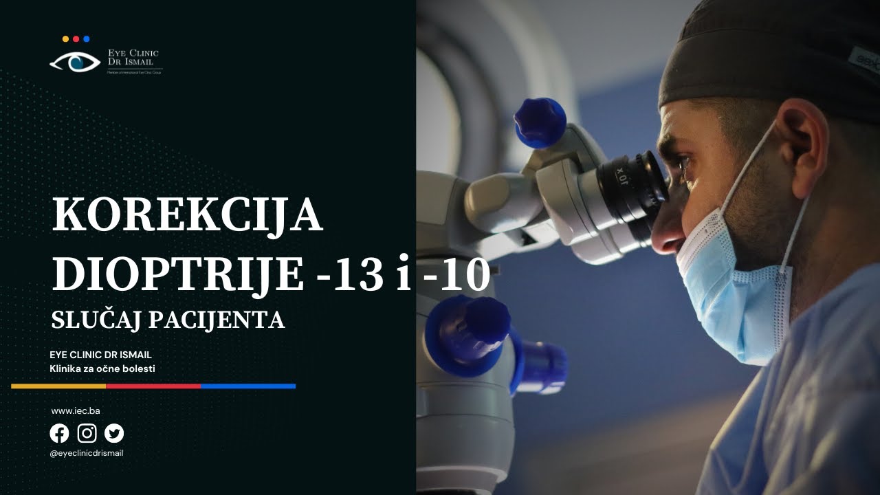 Korekcija dioptrije minus 13 i minus 10 / Ispovijest pacijenta - YouTube