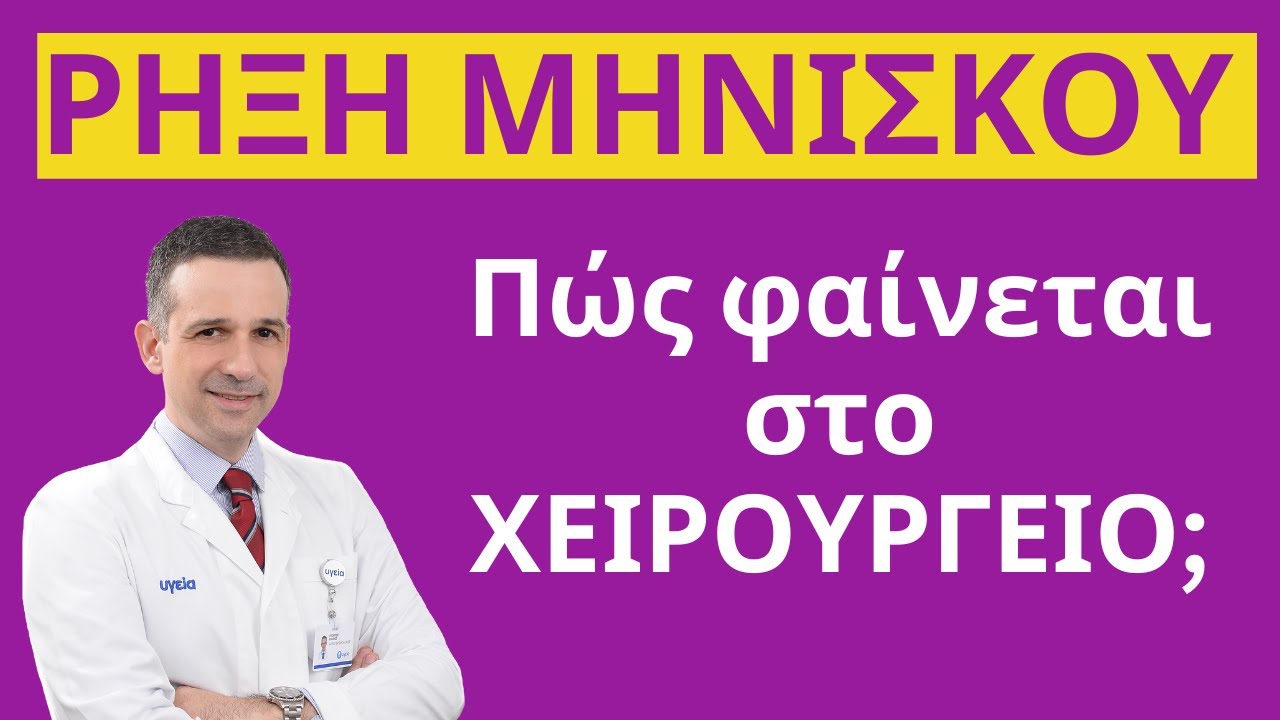 Ρήξη Μηνίσκου: Πώς φαίνεται στο χειρουργείο; @orthopaidikos - YouTube