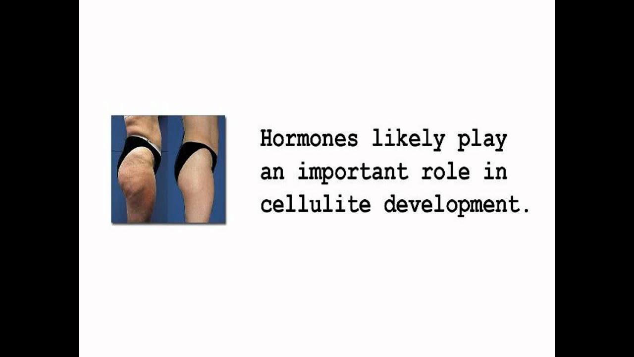 Homemade Cellulite Treatment - YouTube